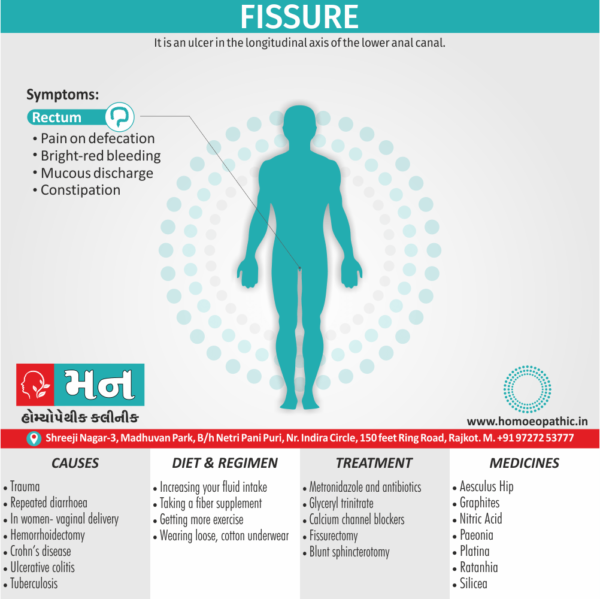 Fissure - Mann Homeopathy Clinic Rajkot