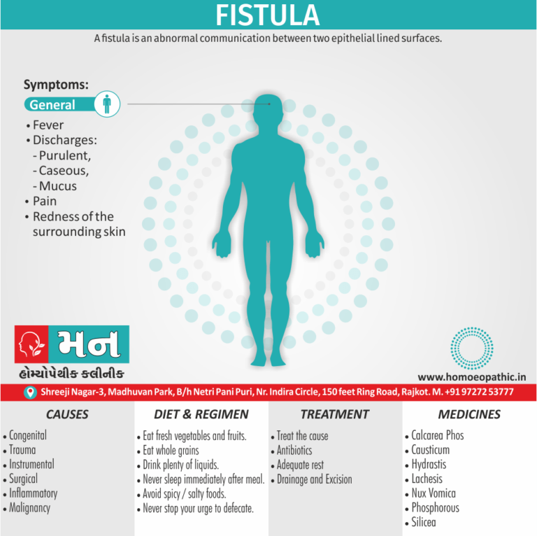 Fistula - Mann Homeopathy Clinic Rajkot