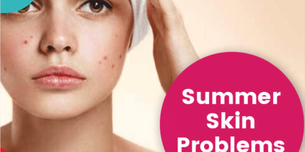 Summer Skin Problems & Solutions - Mann Homeopathy Clinic Rajkot